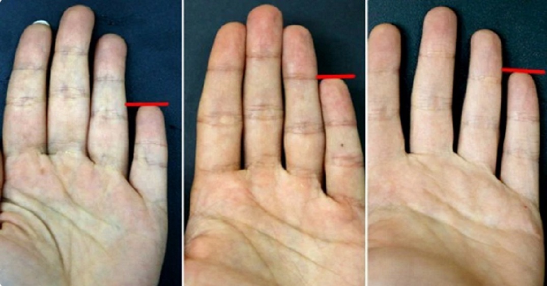 Los Secretos Del Dedo Meñique